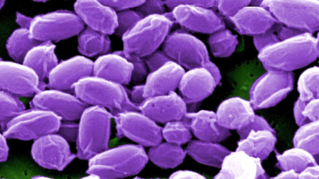 Russia Released A Deadly Anthrax Strain Back in the 1970s - 19FortyFive